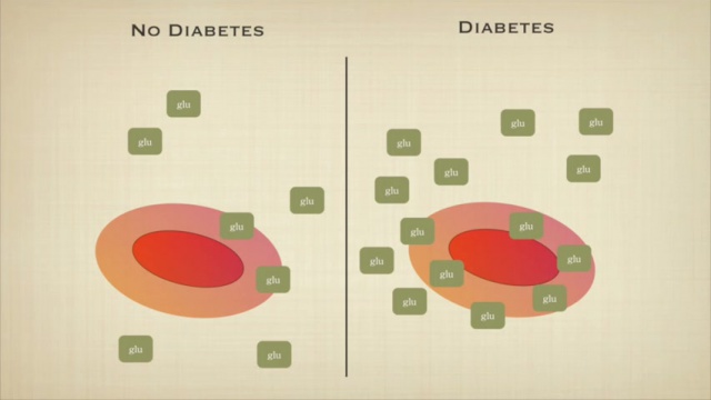 HbA1c: Measure of Diabetes Control